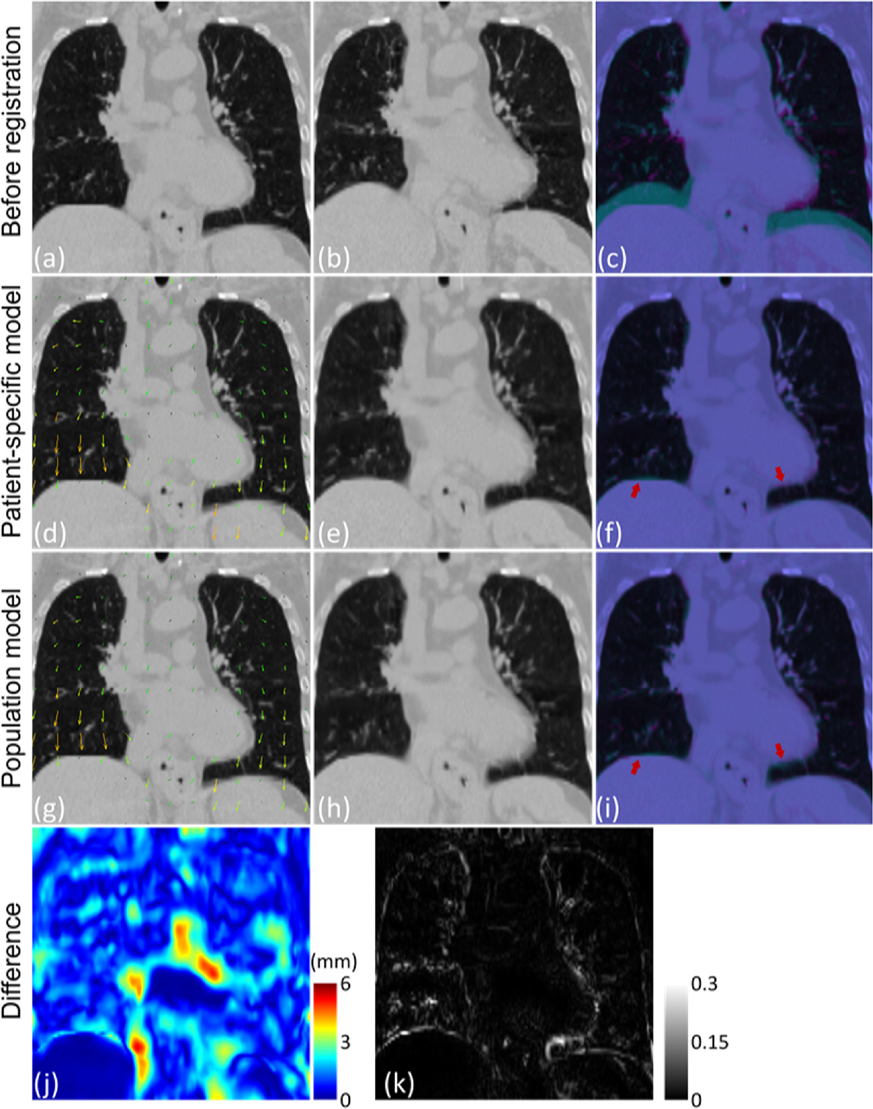 Fast motion-compensated reconstruction for 4D-CBCT using deep learning ...