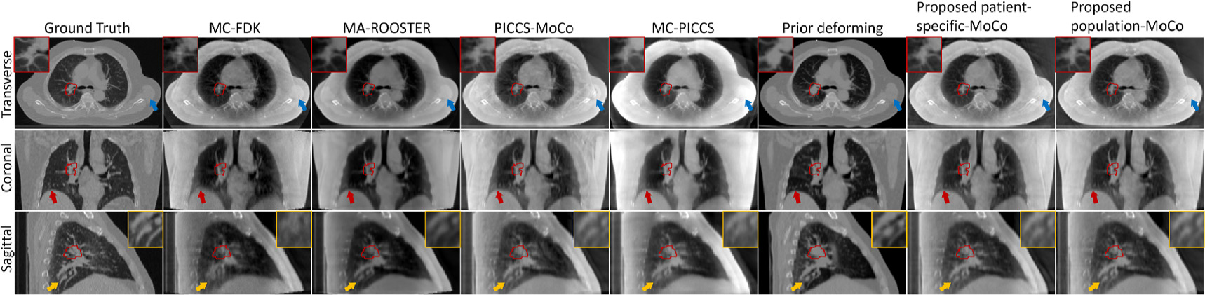 Fast motion-compensated reconstruction for 4D-CBCT using deep learning ...