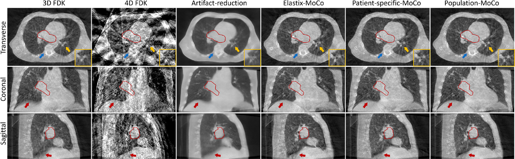 Fast motion-compensated reconstruction for 4D-CBCT using deep learning ...