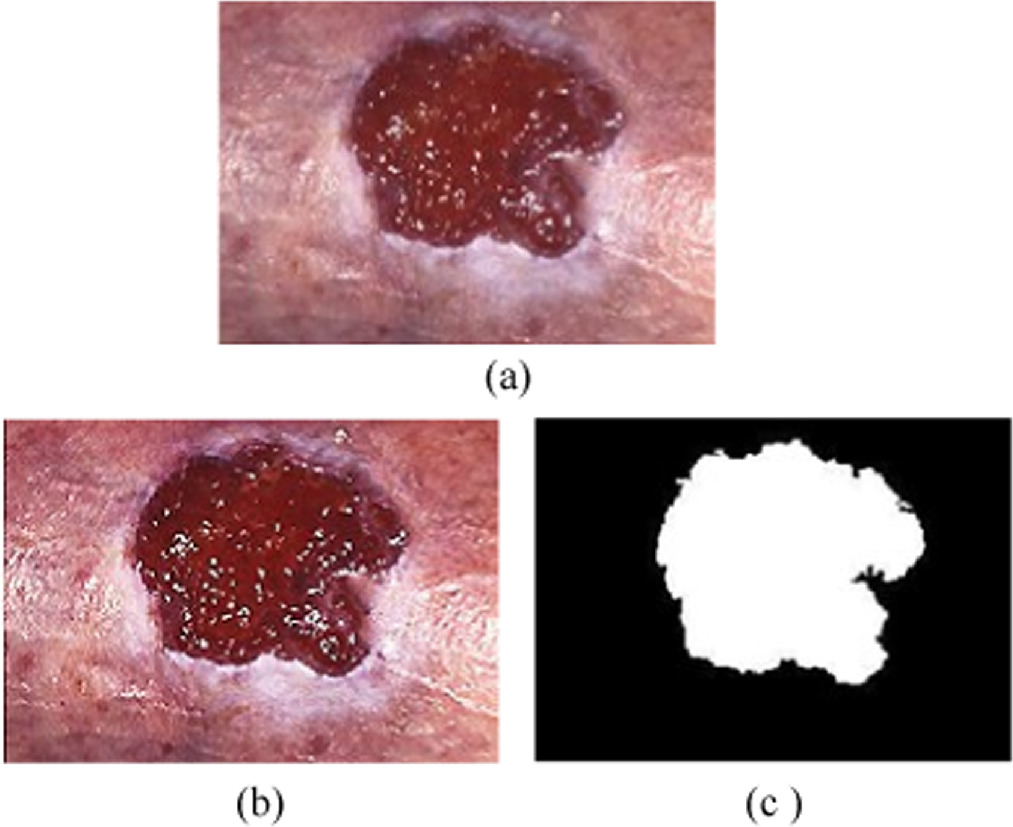 Intelligent progress monitoring of healing wound tissues based on ...