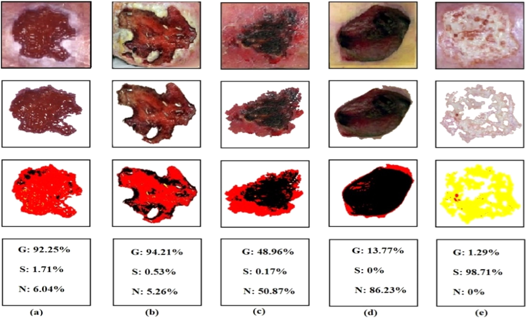 Intelligent progress monitoring of healing wound tissues based on ...