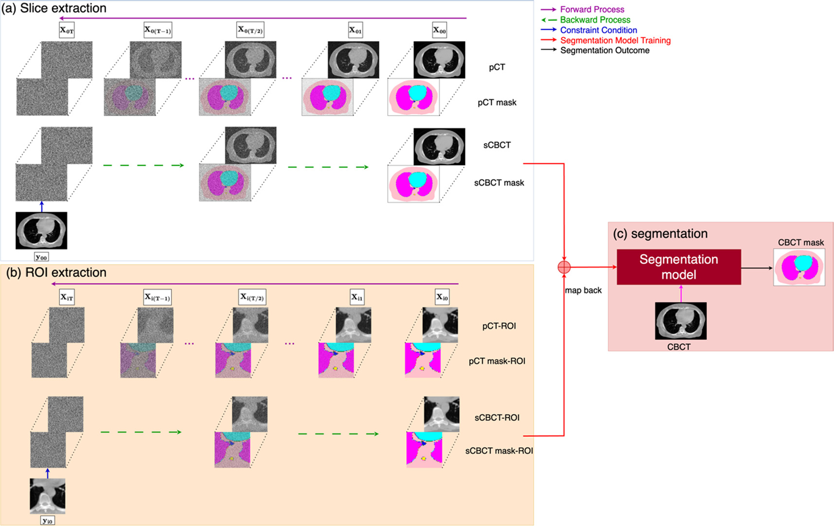 CT-guided CBCT multi-organ segmentation using a multi-channel conditional consistency diffusion ...