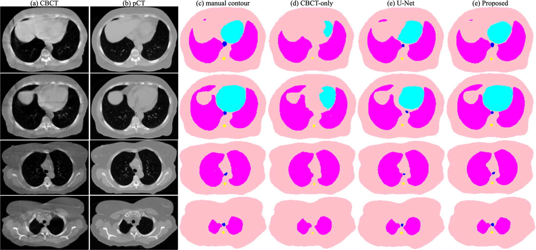 CT-guided CBCT multi-organ segmentation using a multi-channel ...