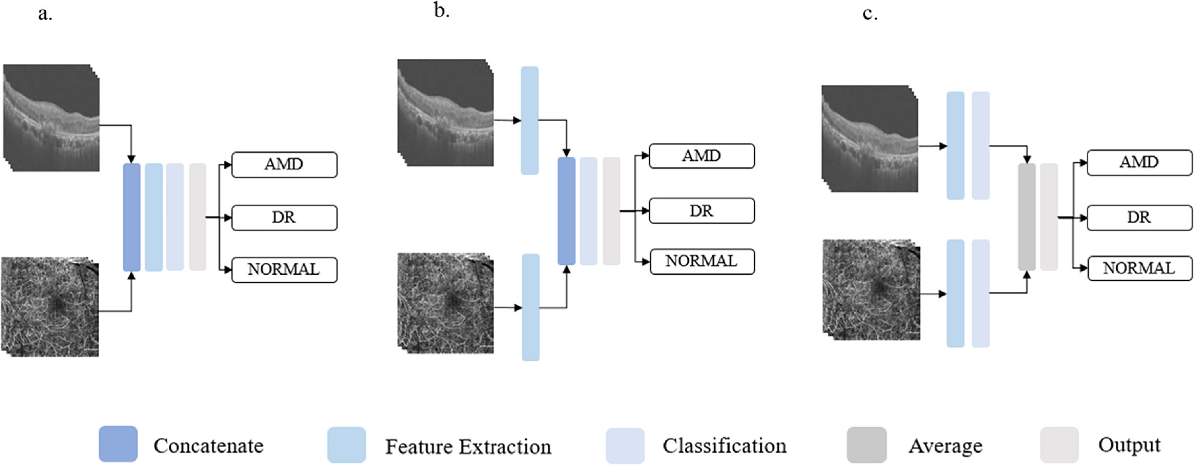Multi-modal classification of retinal disease based on convolutional ...
