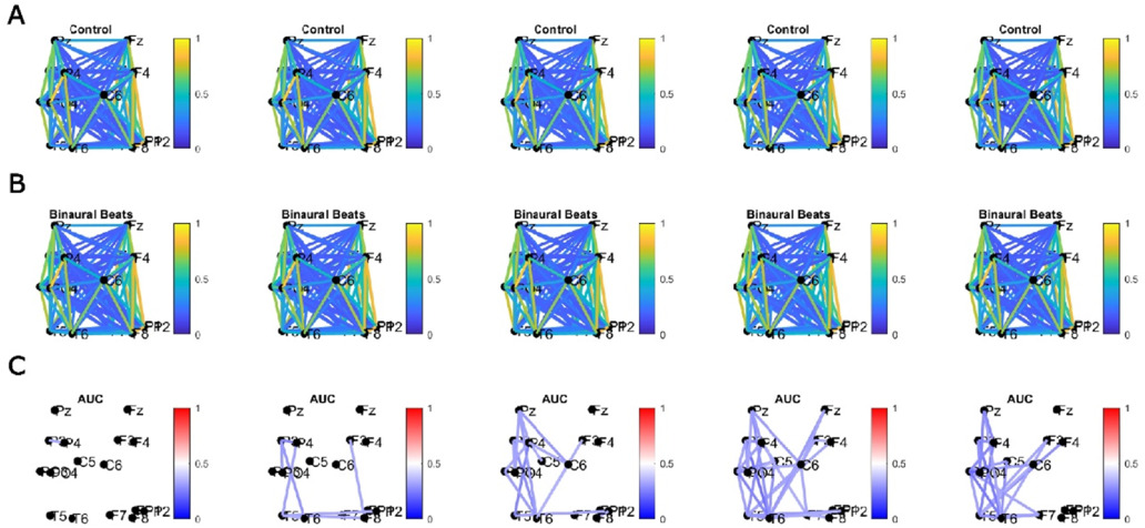 Binaural beat stimulation as a tool to reduce preoperative anxiety in ...
