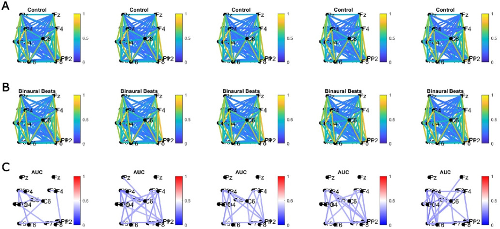 Binaural beat stimulation as a tool to reduce preoperative anxiety in ...