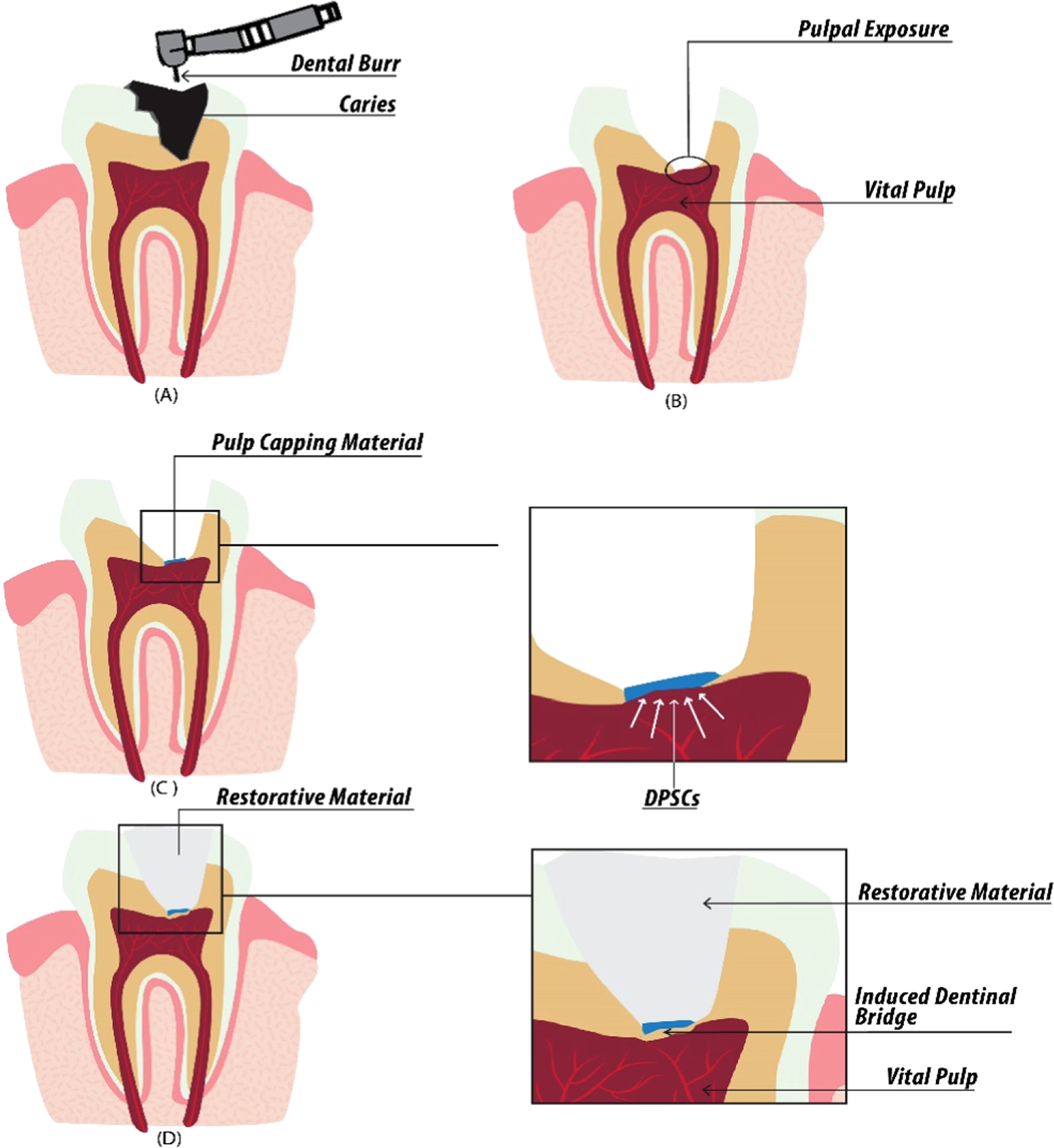 Dental pulp capping materials: modulators of stem cell behavior and ...