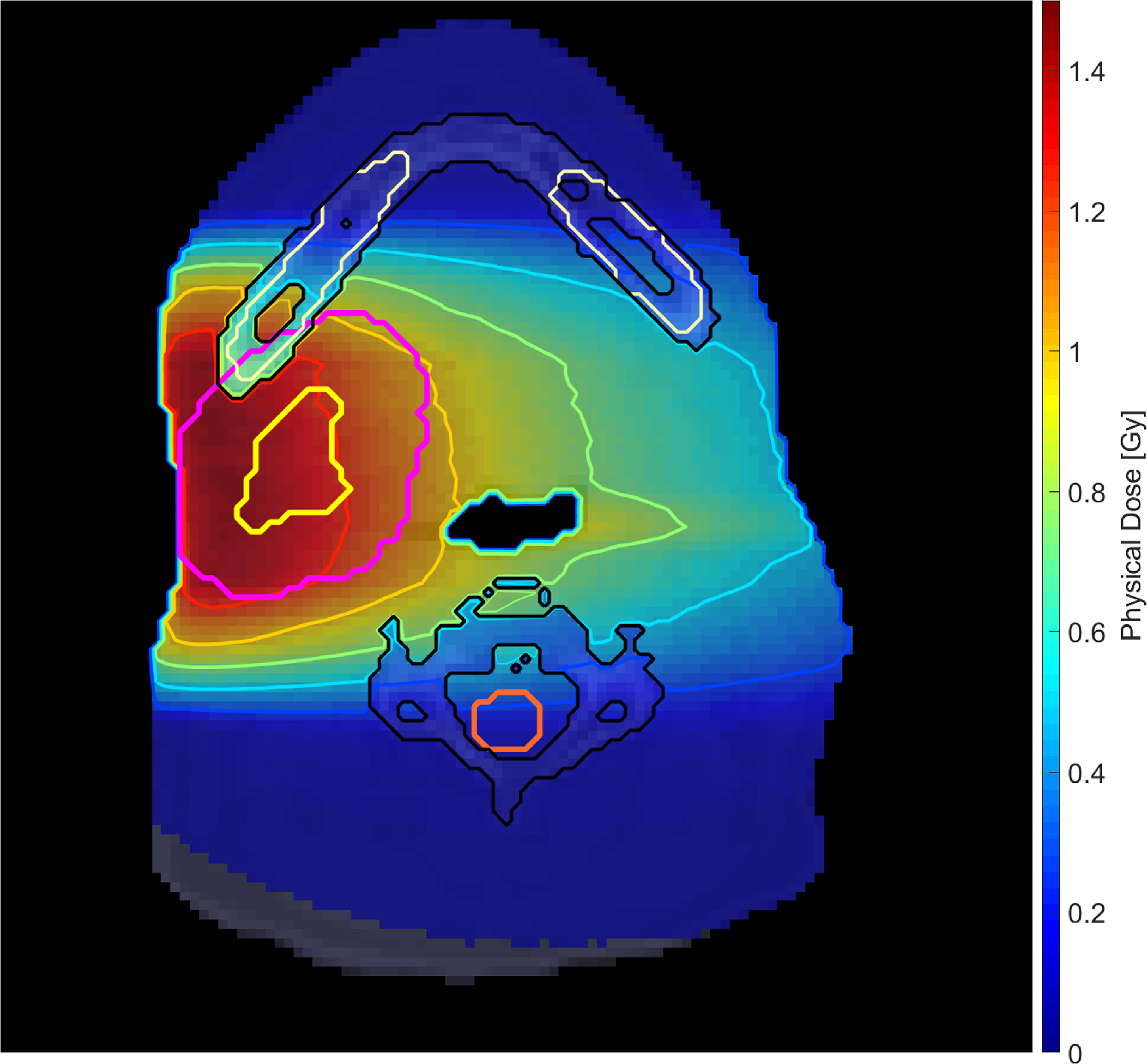 A Monte Carlo dose engine for fast neutron therapy and boron neutron ...