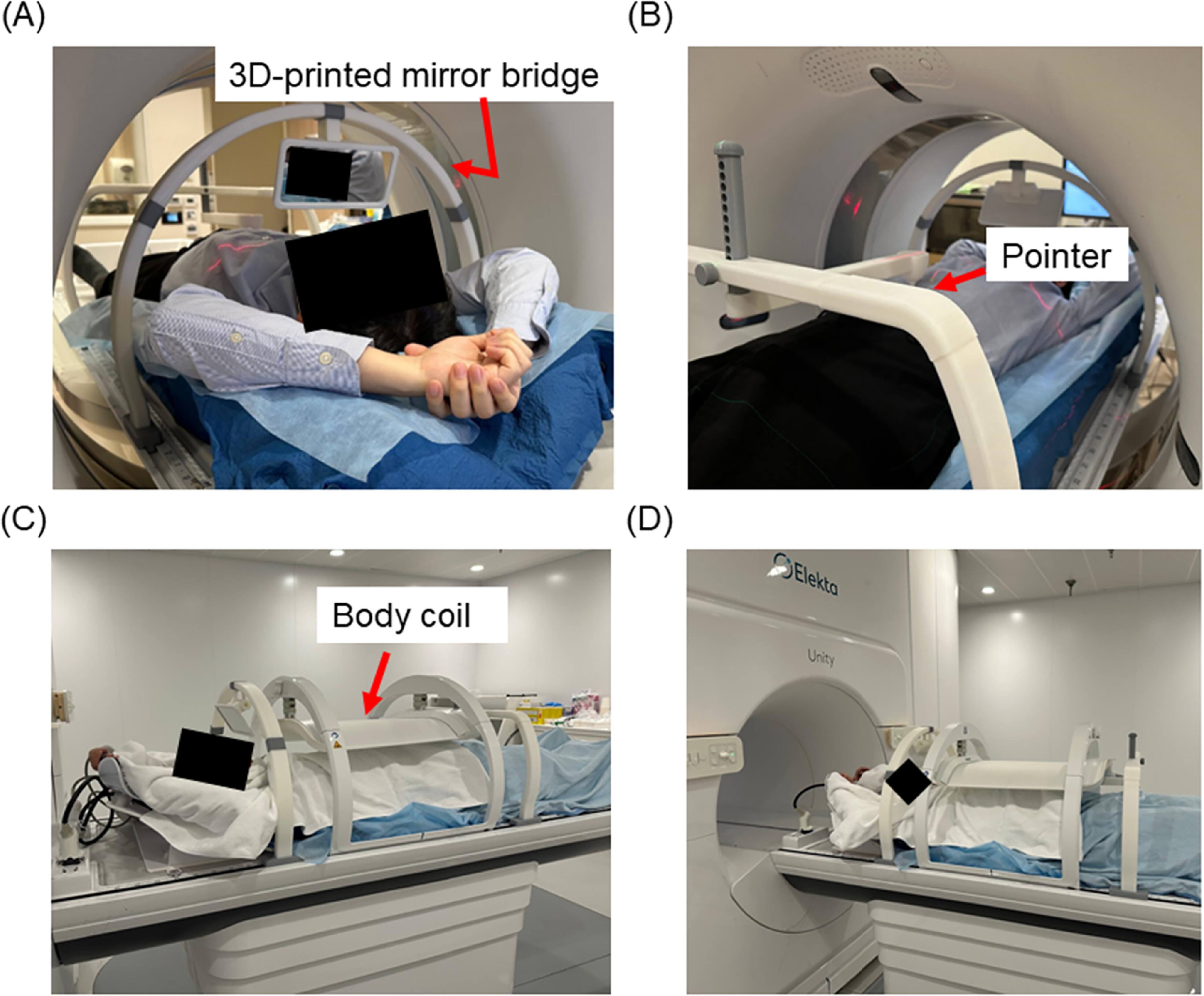 Feasibility of breath-hold gating with visual-tactile guidance on an MR ...