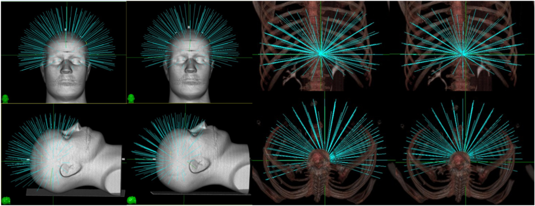 The design and physical characterization of a multileaf collimator for ...