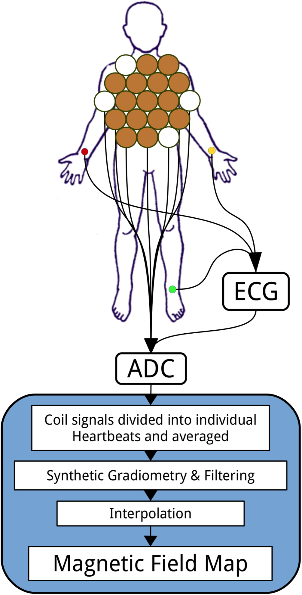 A portable diagnostic device for cardiac magnetic field mapping ...