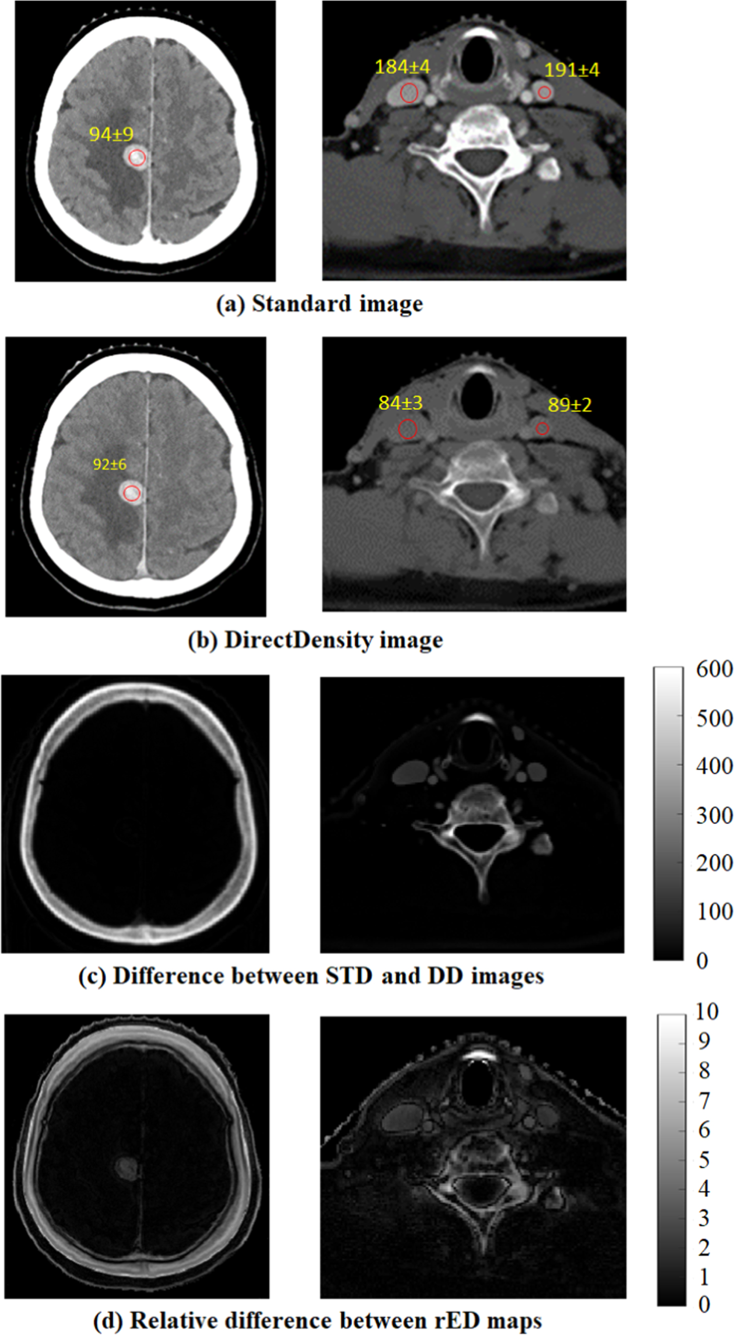 Potentials and limits of a novel CT reconstruction algorithm ...