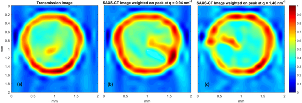 SAXS-CT: a nanostructure resolving microscopy for macroscopic biologic ...