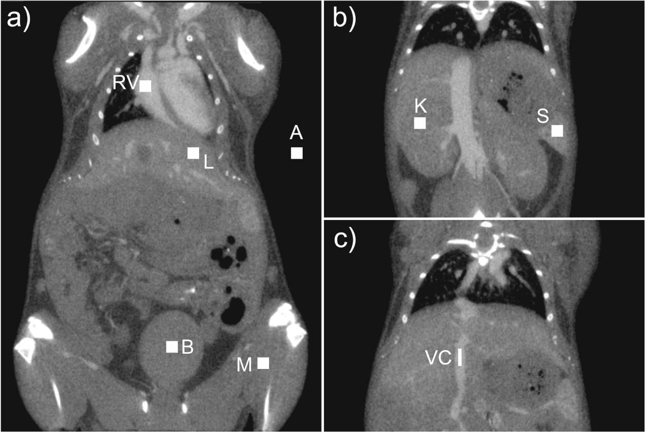 Time-course study of a gold nanoparticle contrast agent for cardiac ...