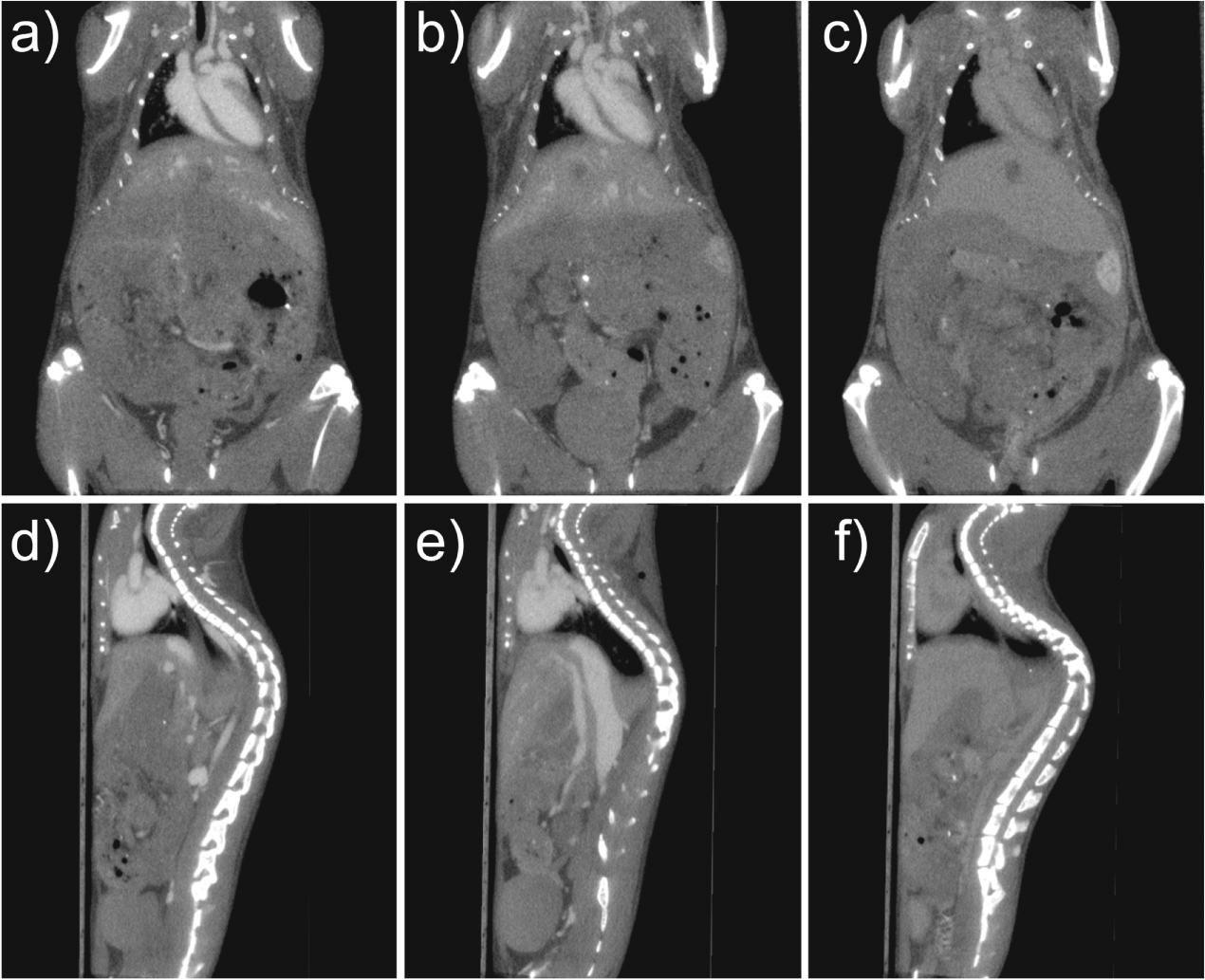 Time-course study of a gold nanoparticle contrast agent for cardiac ...