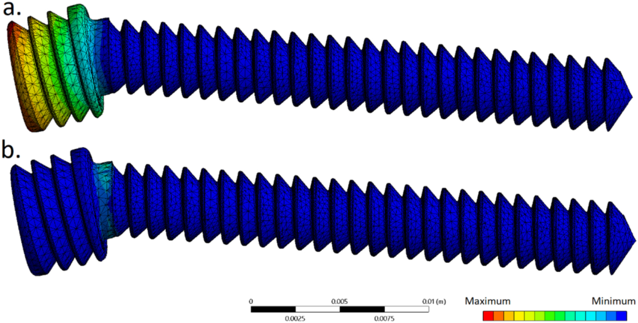 Design and analysis of biodegradable buttress threaded screws for ...