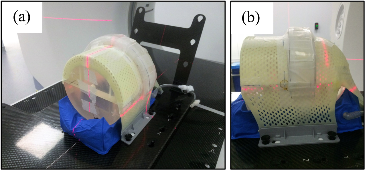 Assessment of a commercial EPID dosimetry system to detect radiotherapy ...