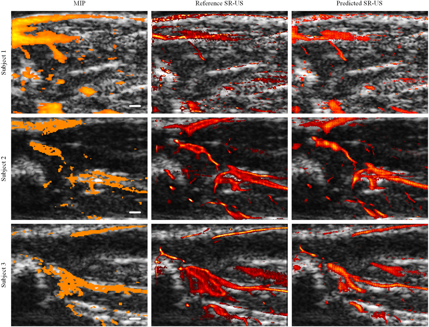 Faster super-resolution ultrasound imaging with a deep learning model ...