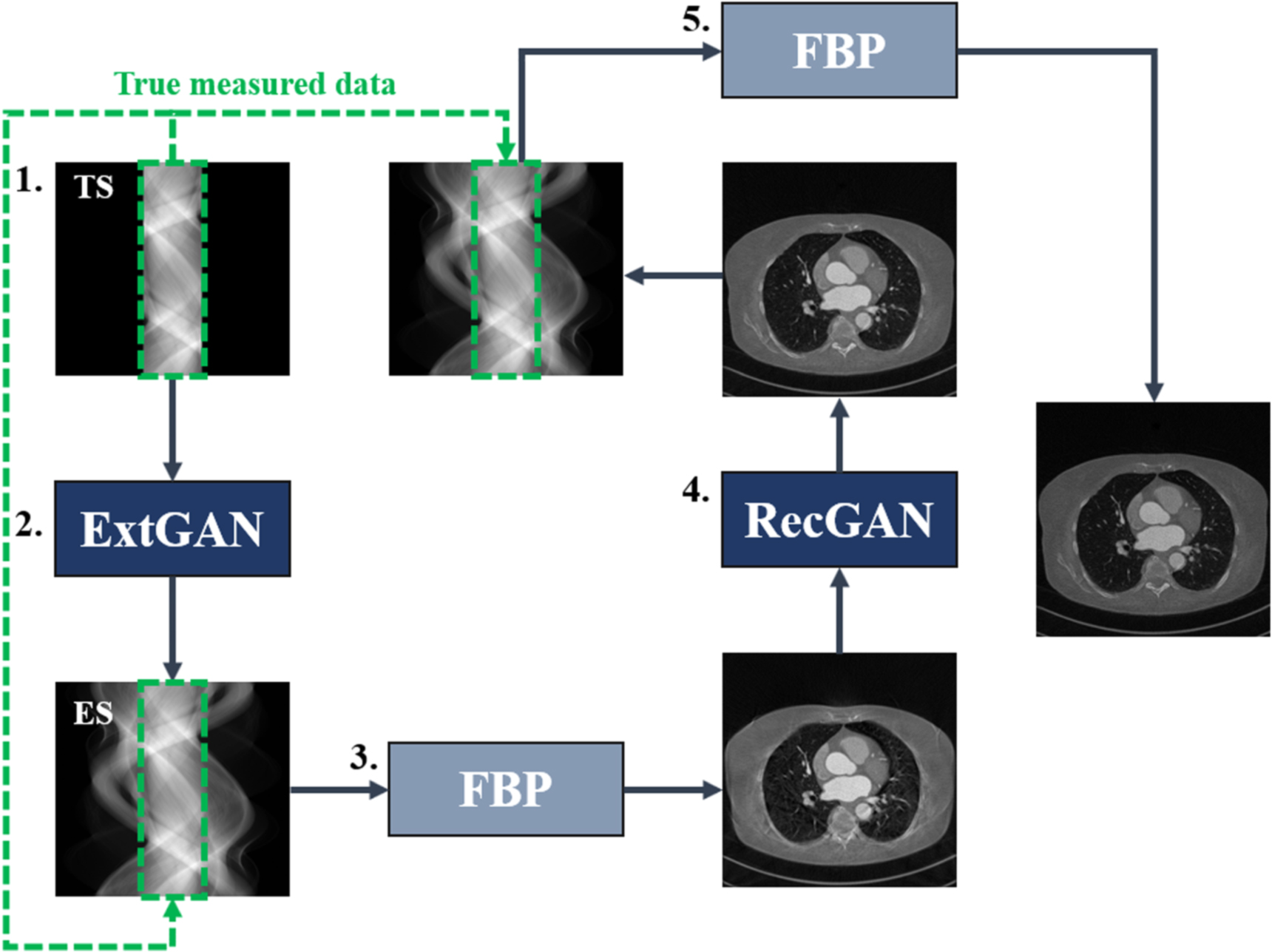 Generative adversarial networks improve interior computed tomography ...