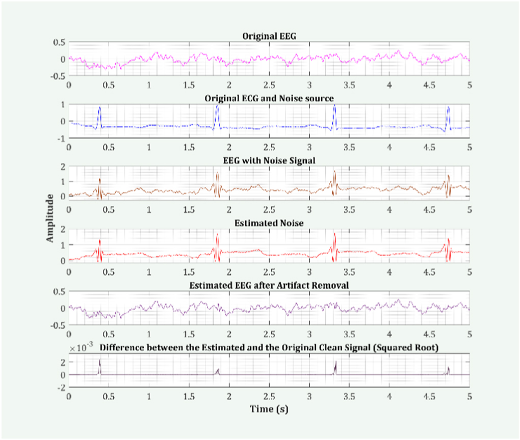 Understanding the nonlinear behavior of EEG with advanced machine learning in artifact ...