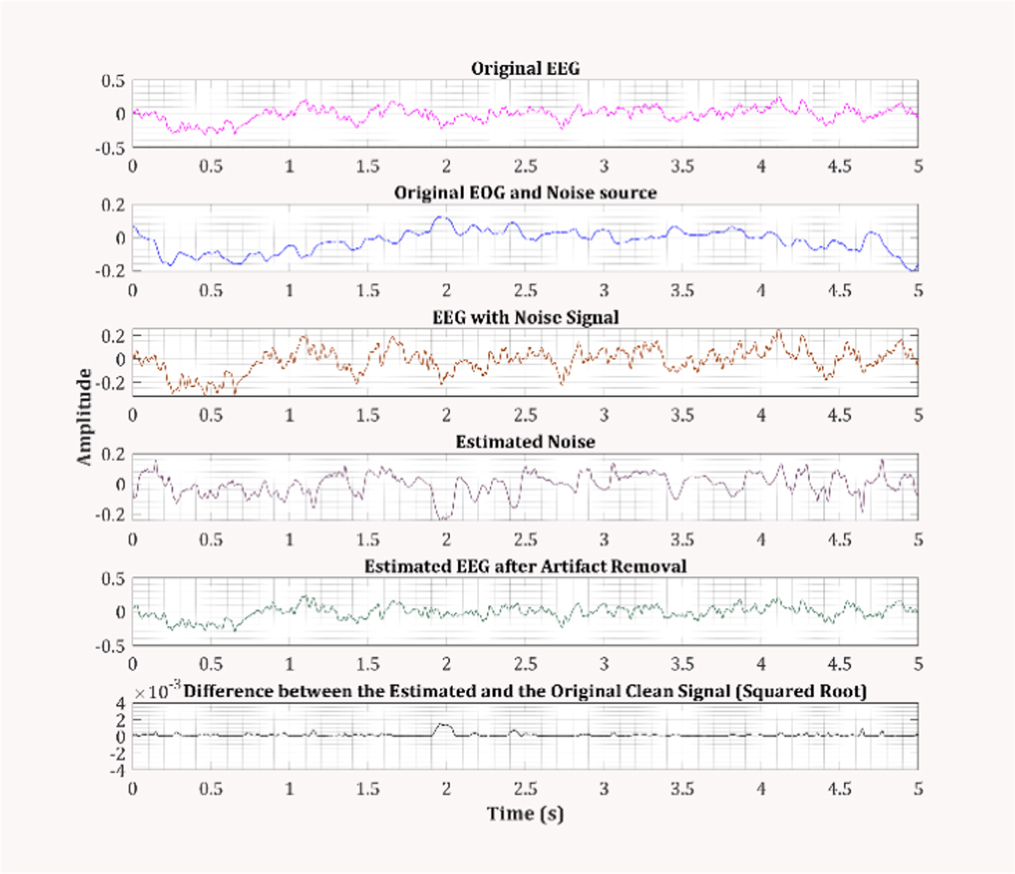 Understanding the nonlinear behavior of EEG with advanced machine learning in artifact ...