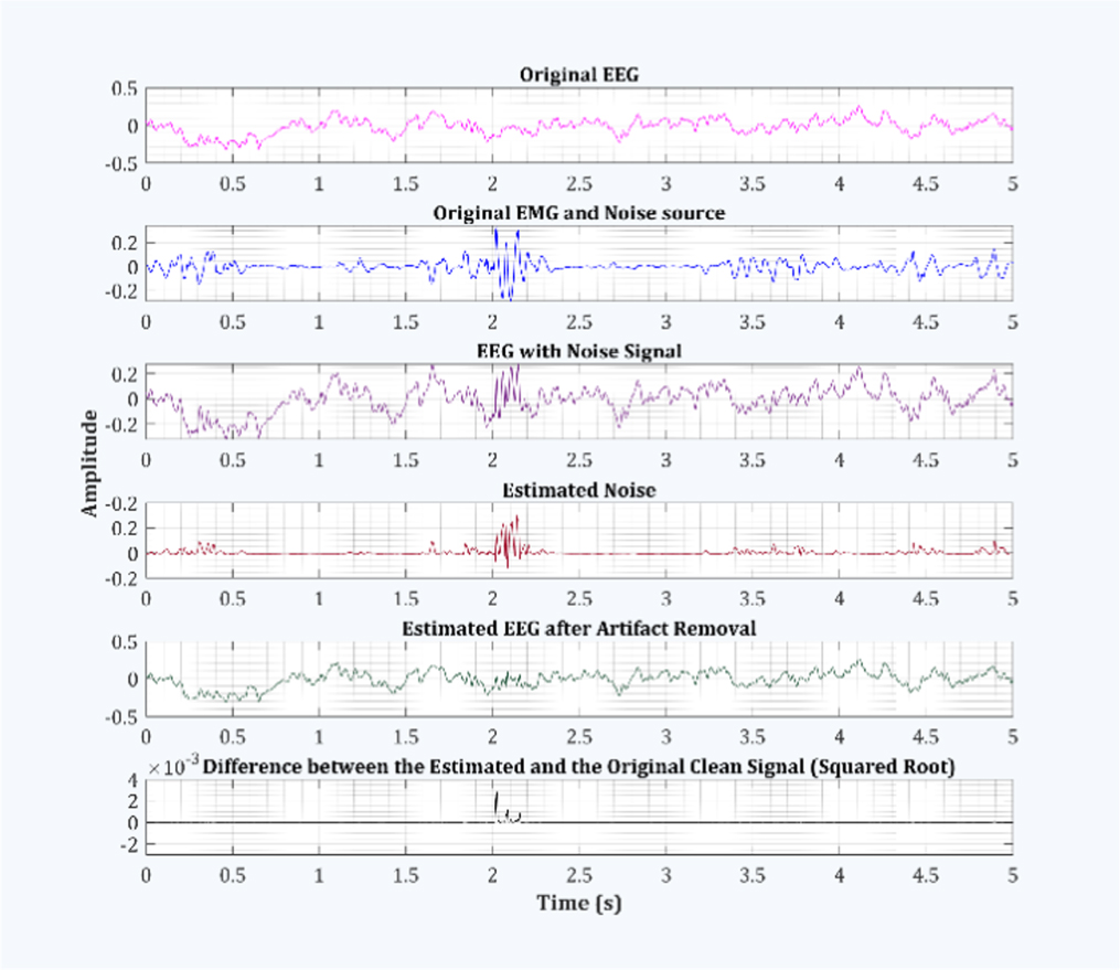 Understanding the nonlinear behavior of EEG with advanced machine learning in artifact ...