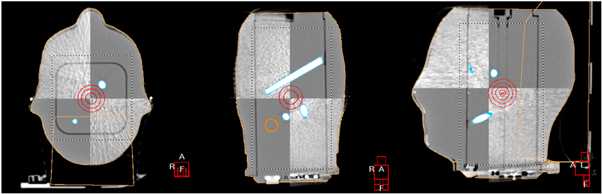Systematic end-to-end testing of multiple target treatments using the ...