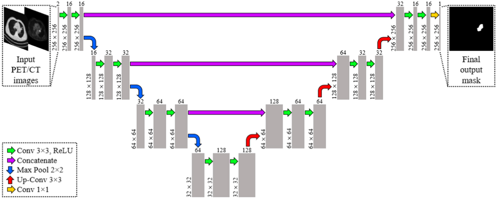 A few-shot U-Net deep learning model for lung cancer lesion ...