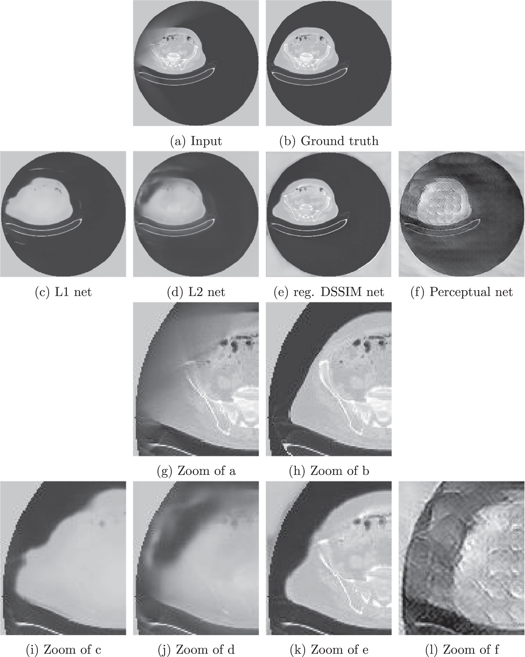 Deep learning-based extended field of view computed tomography image ...