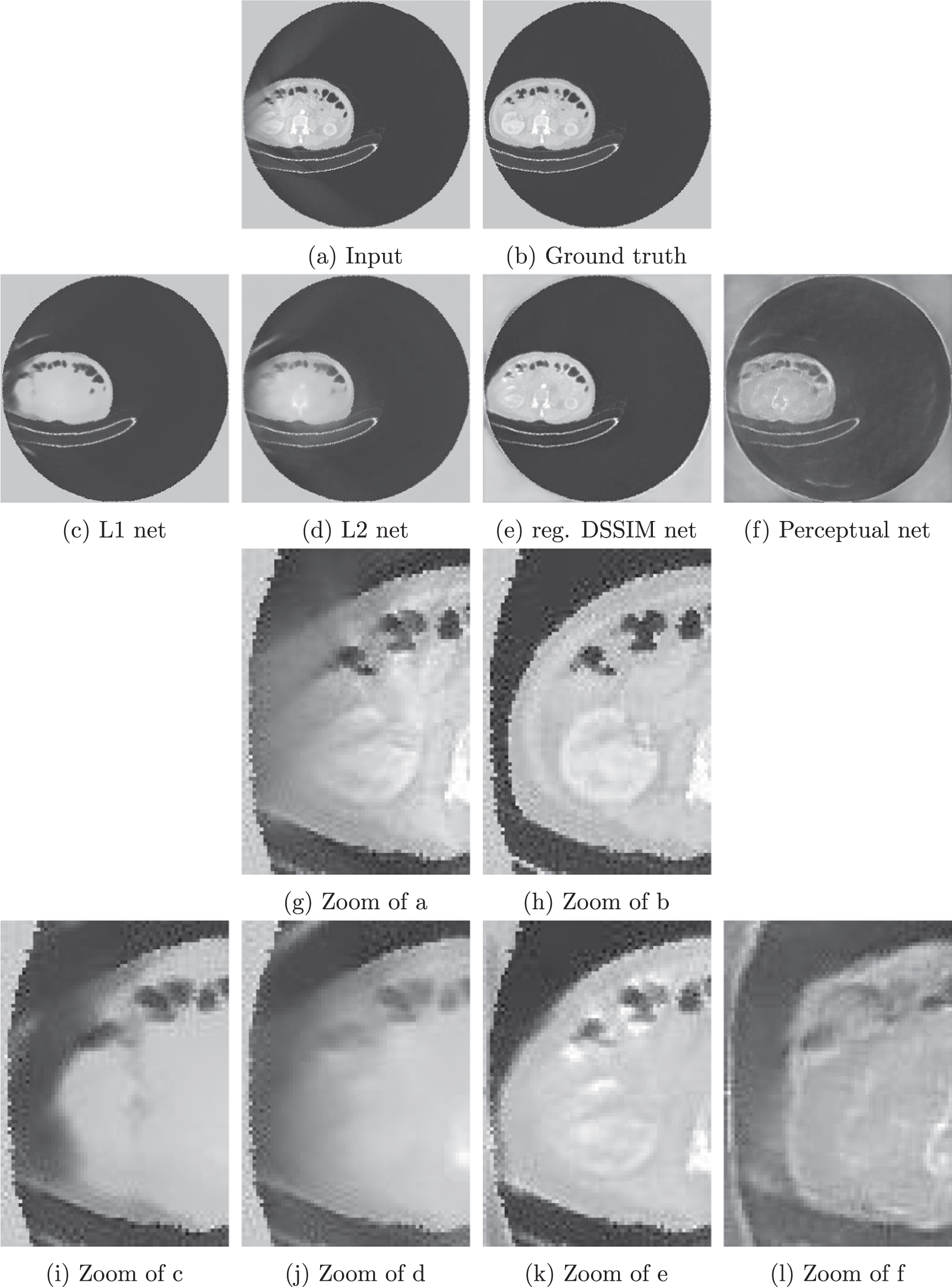 Deep learning-based extended field of view computed tomography image ...