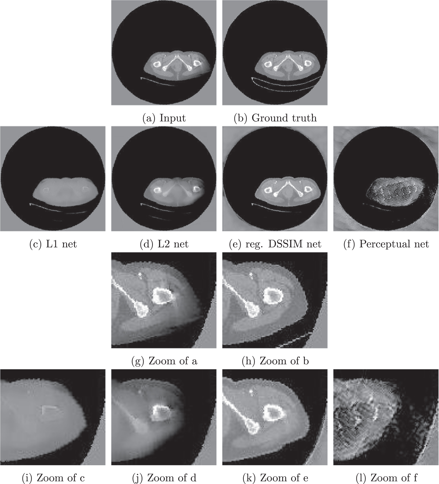 Deep learning-based extended field of view computed tomography image ...
