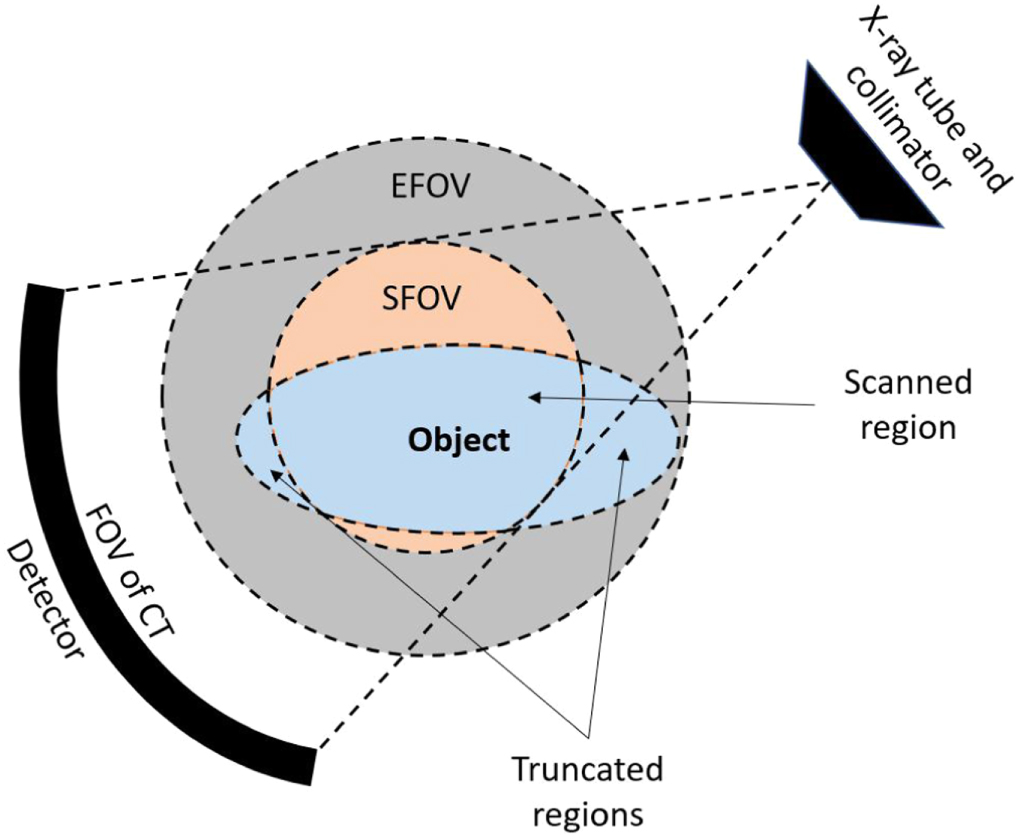 Deep learning-based extended field of view computed tomography image ...
