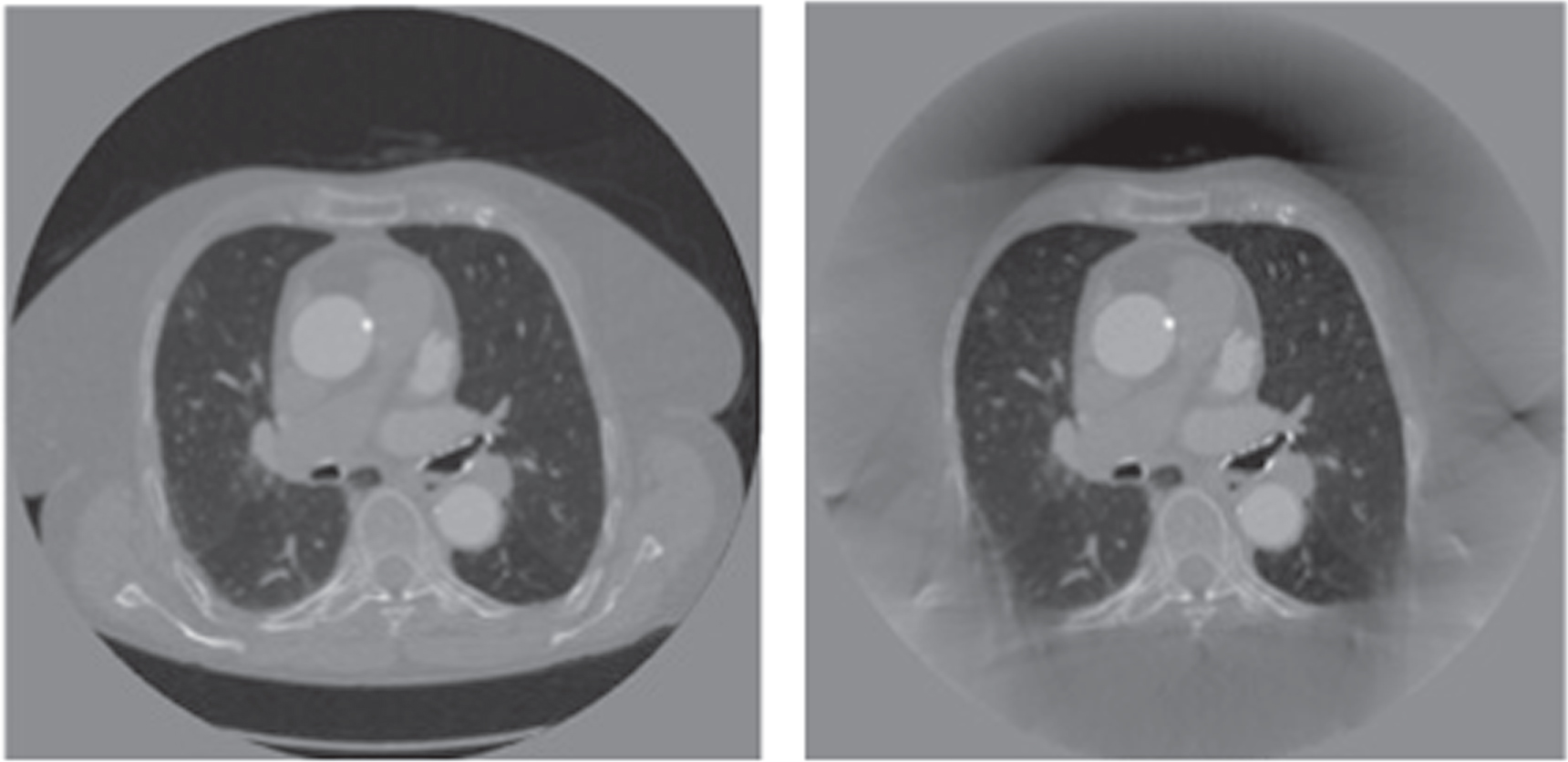 Deep learning-based extended field of view computed tomography image ...