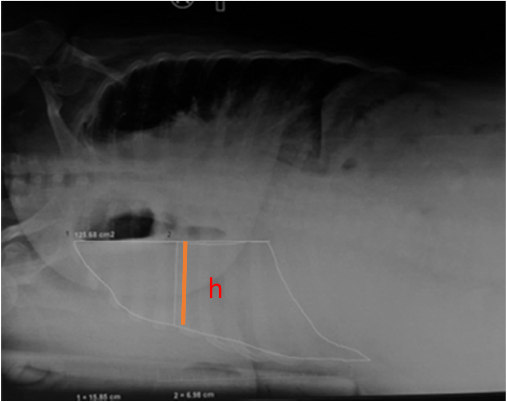 Comparative estimation of pleural effusion volume based on lateral ...