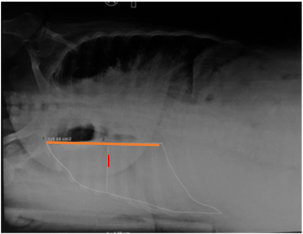 Comparative estimation of pleural effusion volume based on lateral ...