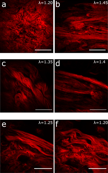 Visualizing dynamic three-dimensional changes of human reticular dermal ...