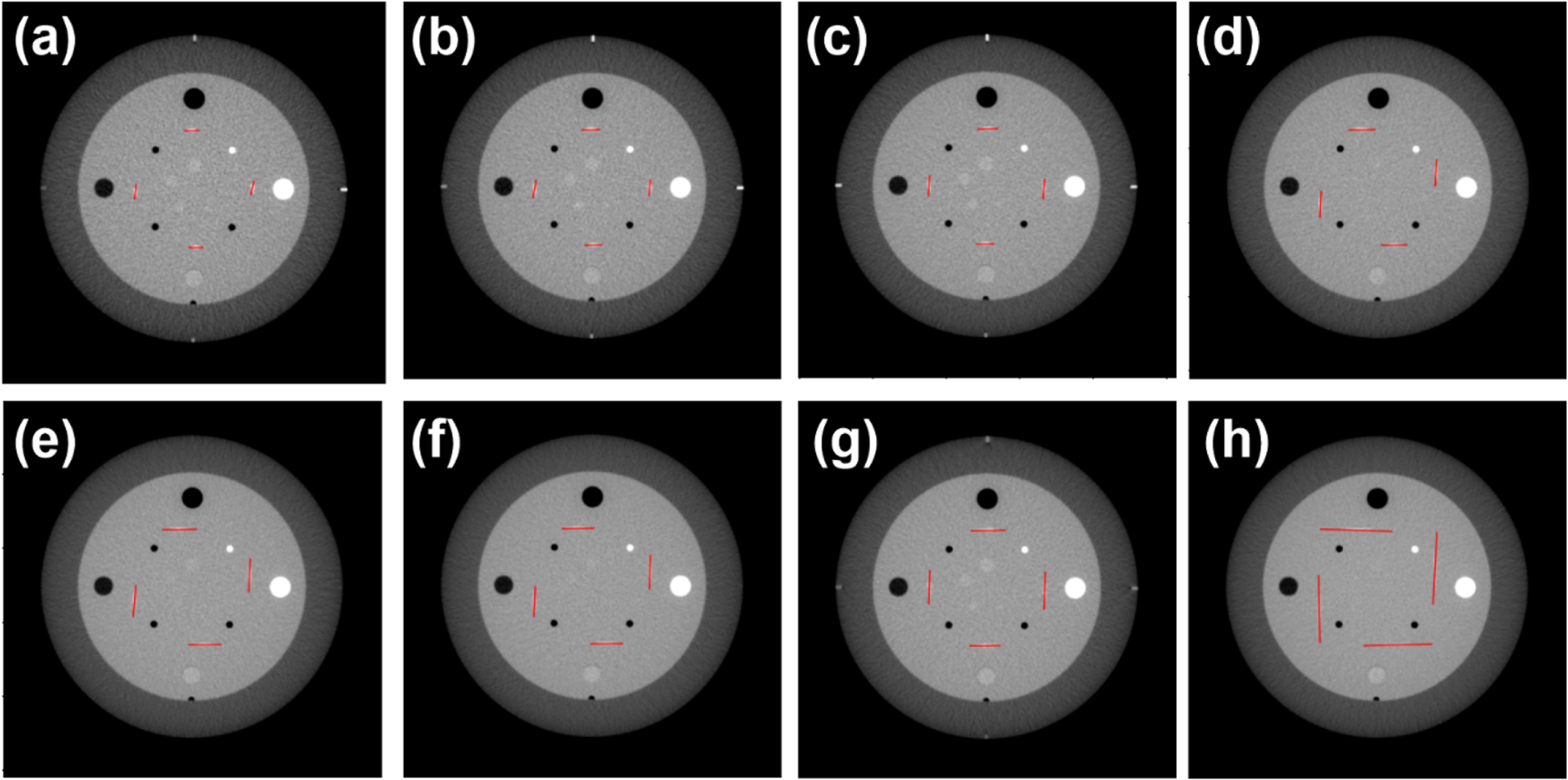 Automatic slice thickness measurement on three types of Catphan CT ...
