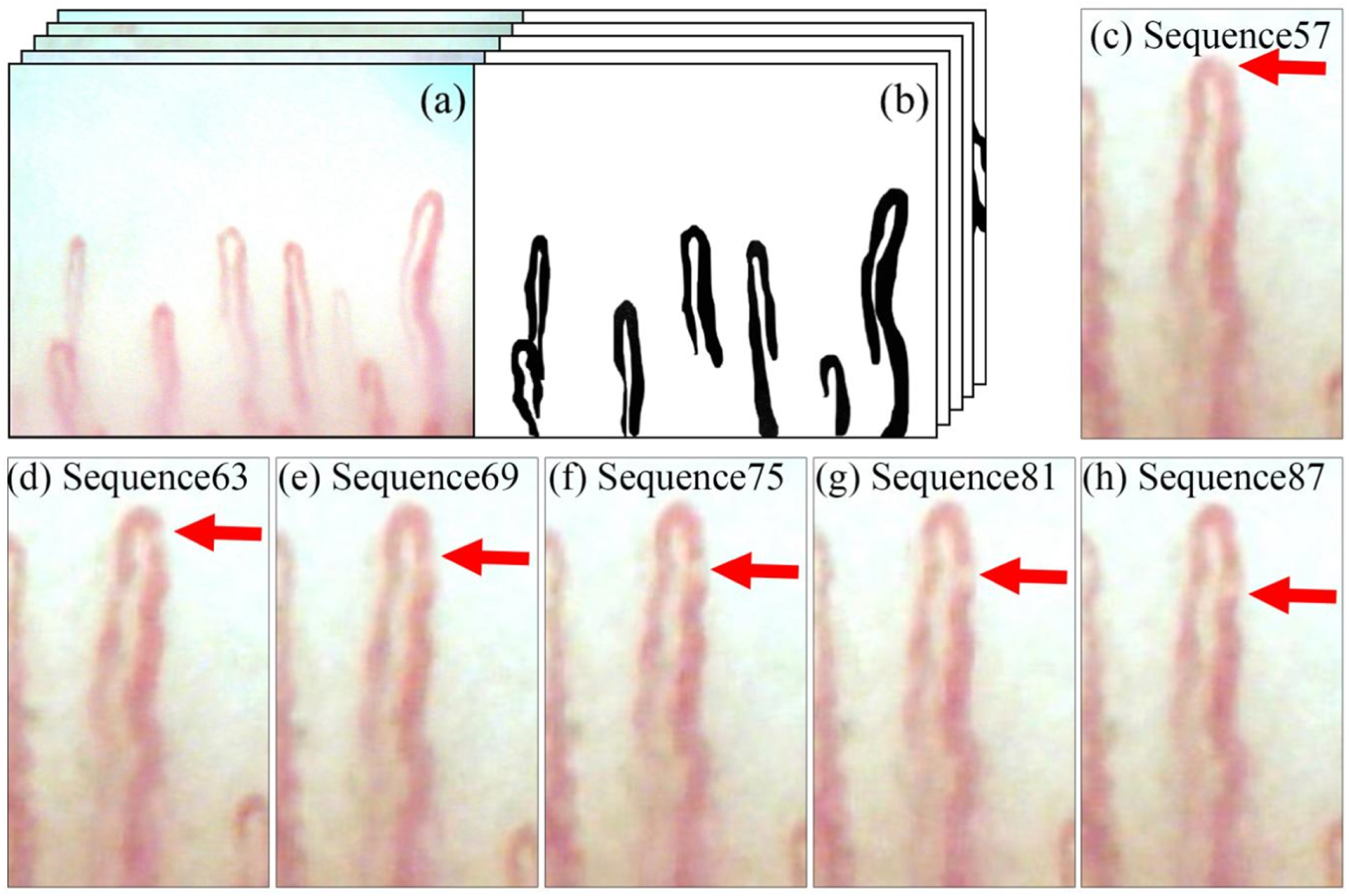 Blood flow characterization in nailfold capillary using optical flow ...