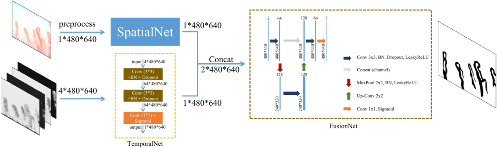 Blood flow characterization in nailfold capillary using optical flow ...
