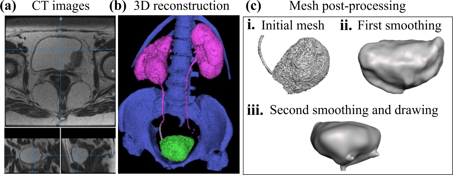 Urinary bladder phantom mimicking mechanical properties and pressure ...