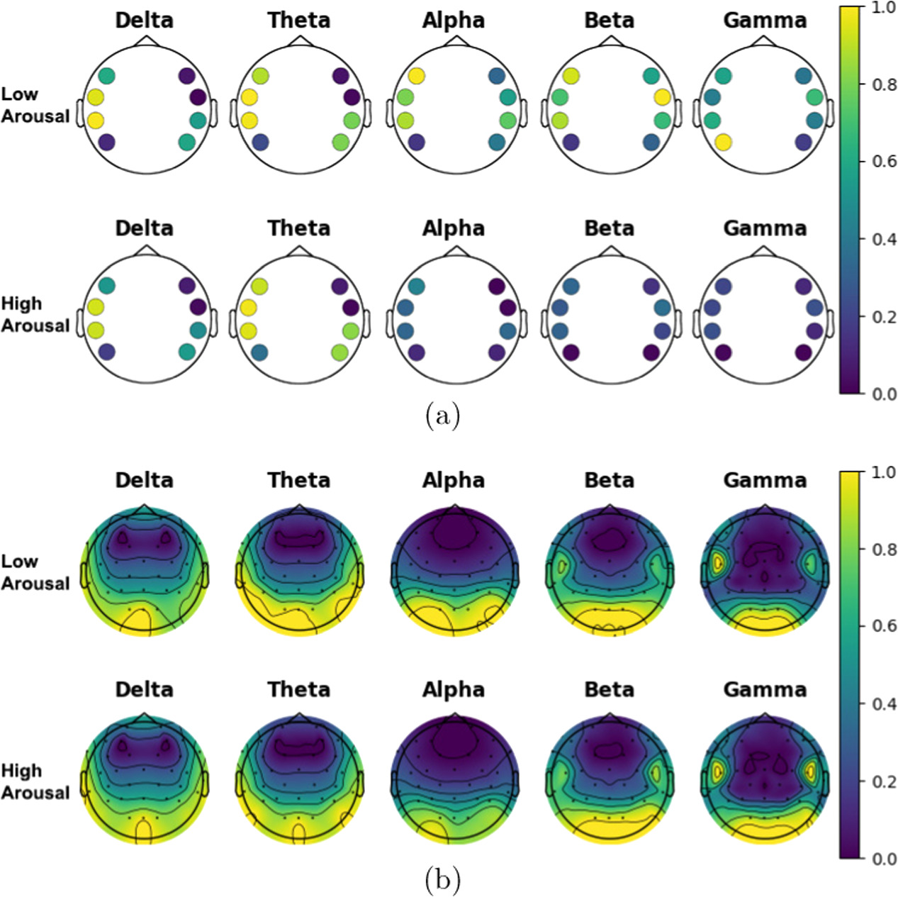 Decoding auditory-evoked response in affective states using wearable ...