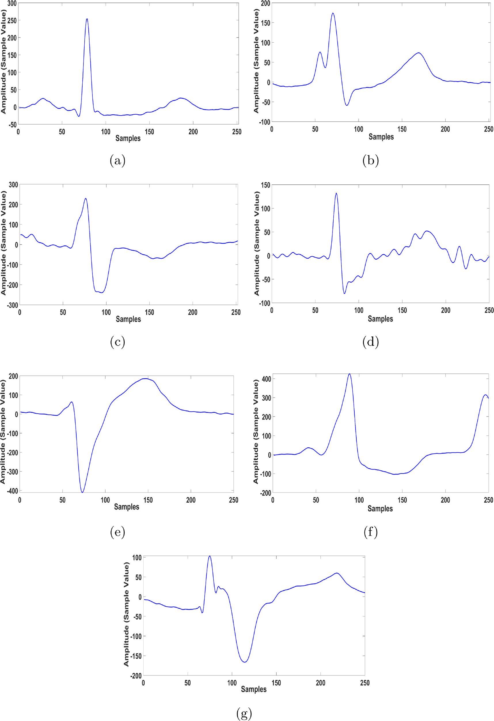 Electrocardiogram morphological arrhythmia classification using fuzzy ...