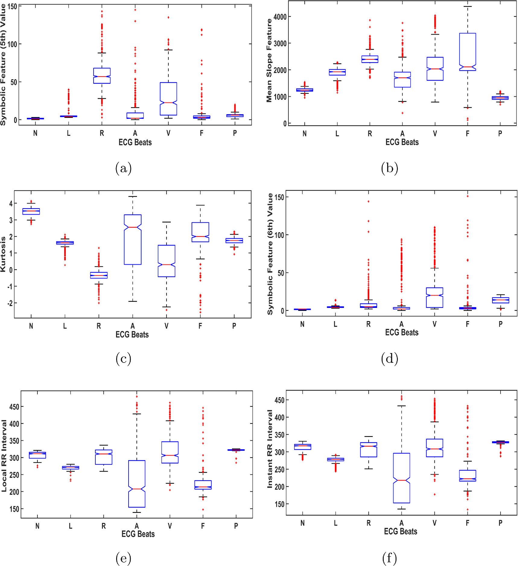 Electrocardiogram morphological arrhythmia classification using fuzzy entropy-based feature ...