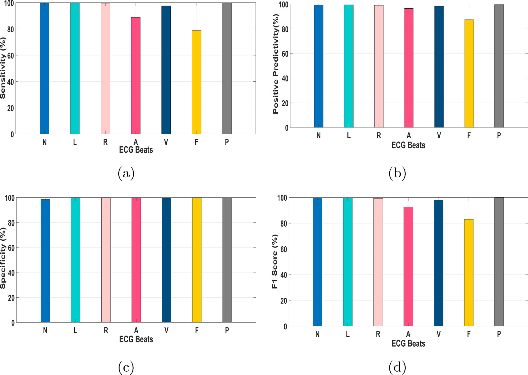 Electrocardiogram morphological arrhythmia classification using fuzzy entropy-based feature ...