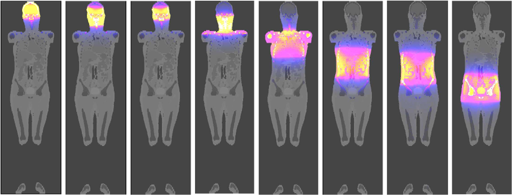 Simulation study on the conversion between CT and CBCT dose quantities ...