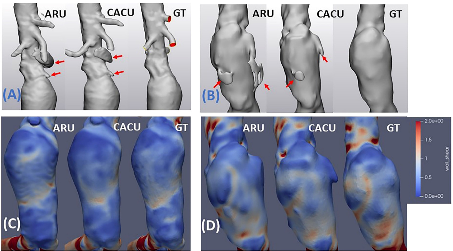 Deep-learning-based image segmentation for image-based computational hemodynamic analysis of ...