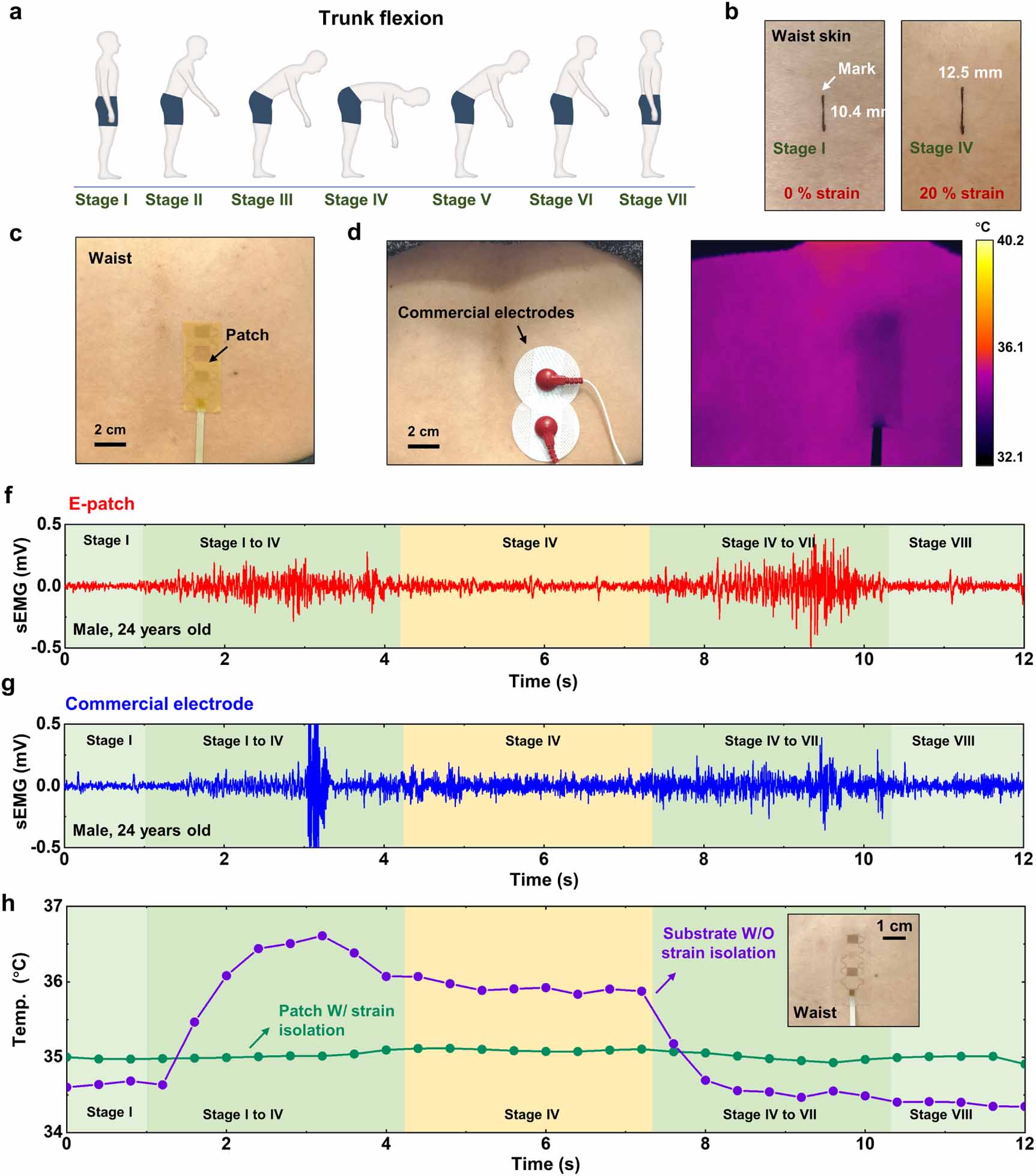 Stretchable electronic skin patch with strain isolation for the ...