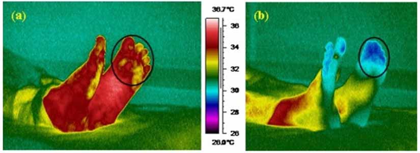 Additively fabricated on-skin sensors for mechanical and thermal ...