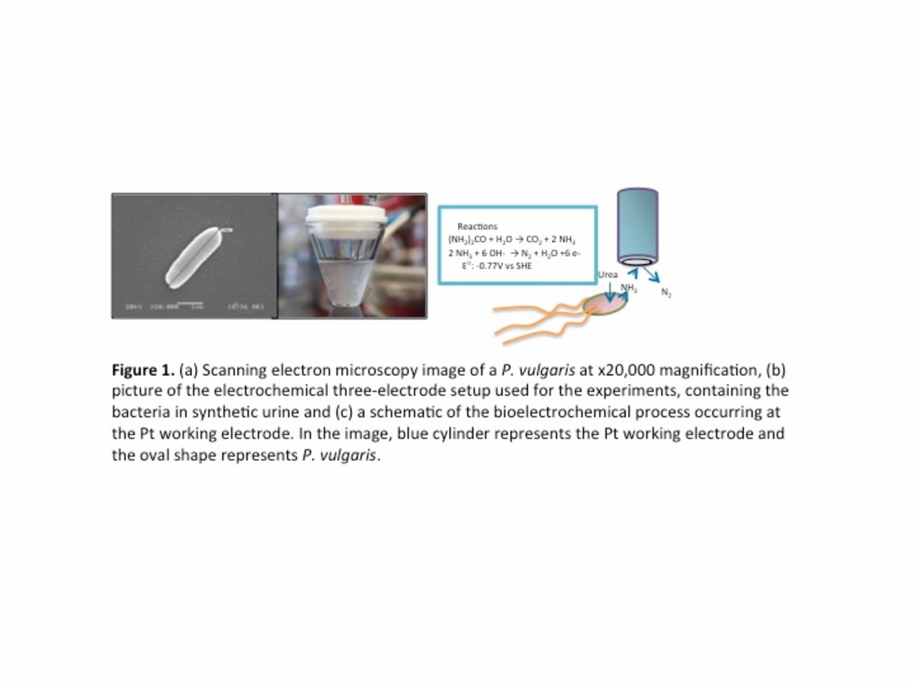 Proteus vulgaris Microbial System for Urea Removal and Sensing in ...