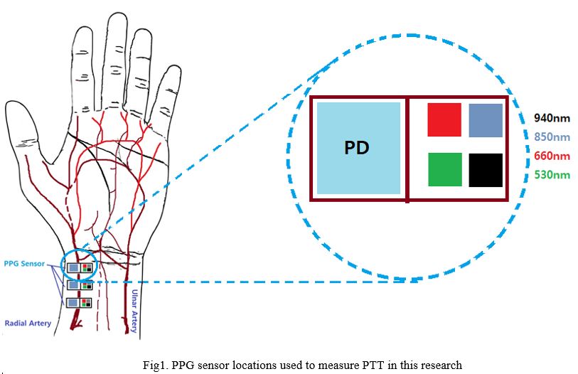 Blood Pressure Estimation Using Custom Photoplethysmography Sensors Located on Radial Artery at ...